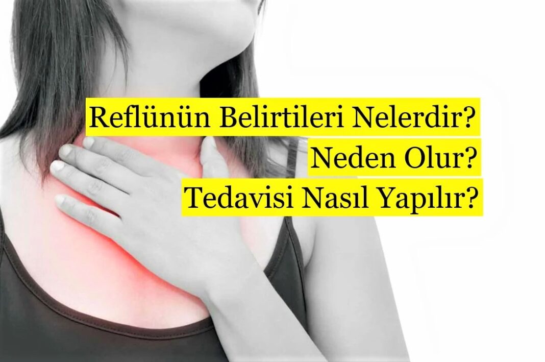 Reflünün Belirtileri Nelerdir? Neden Olur? Tedavisi Nasıl Yapılır ...